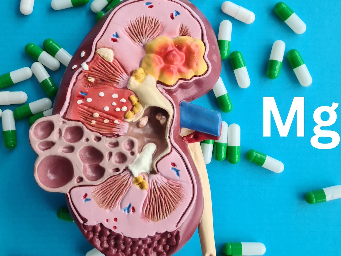 Magnesium To Prevent Kidney Stones | Natural Awakenings Metro Phoenix ...
