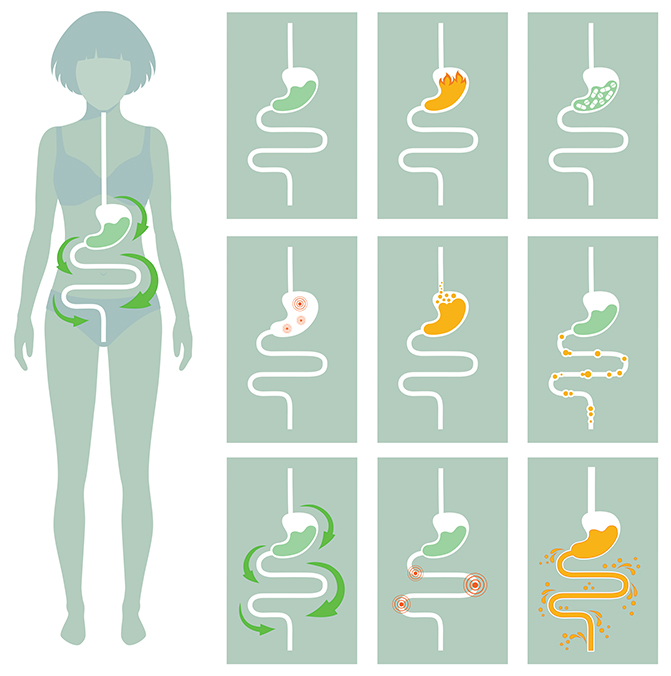 Leaky Gut Syndrome : What Is It and Why Does It Matter? | Natural ...