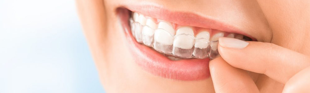 Wow! Smiles Bernstein Orthodontics